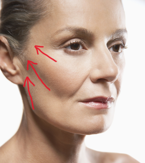 Minimal Incision Facelift - Minimal Incision Surgery