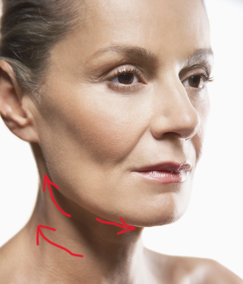 Minimal Incision Facelift - Minimal Incision Surgery